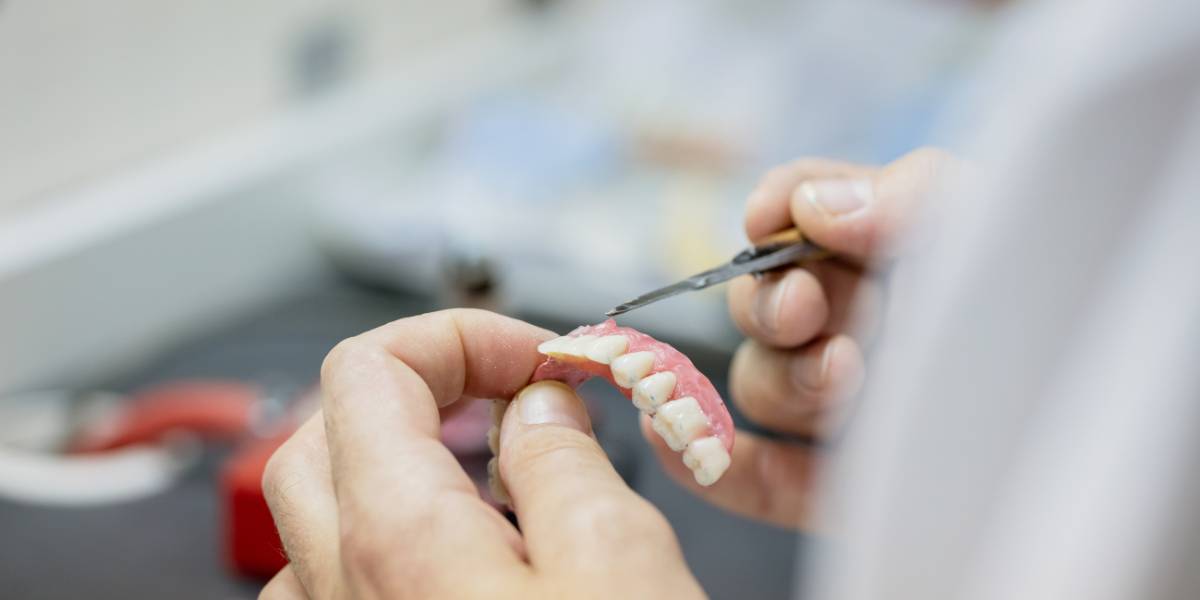 Prótese dentária fixa preço Portugal: Uma análise - Cidade Viva