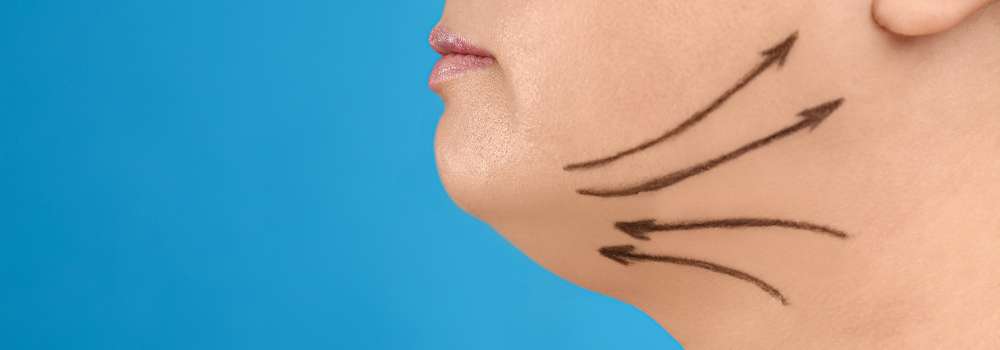 Lipopapada: Elimine A Gordura Submentoniana Sem Cirurgia - Cidade Viva